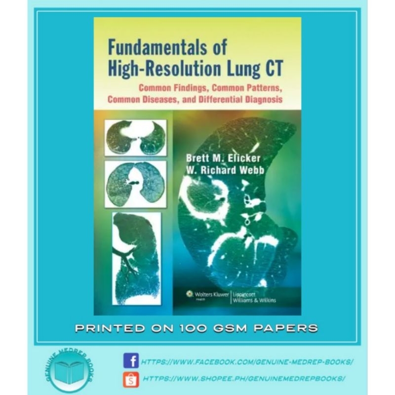 FUNDAMENTALS OF HIGH-RESOLUTION LUNG CT 1ST EDITION | Shopee Malaysia