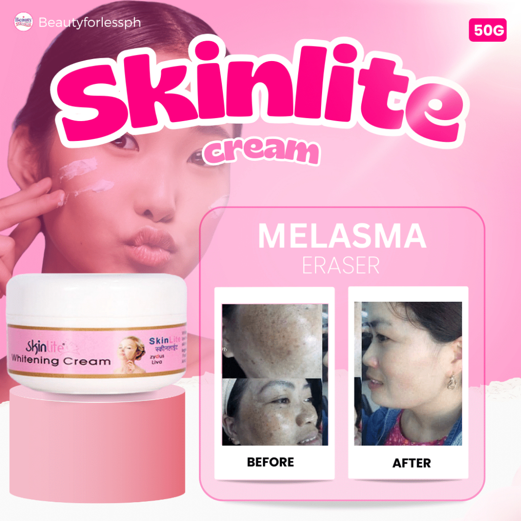 AUTHENTIC SKINLITE Whitening Cream 50g | Even Out Skin Tone Melasma ...