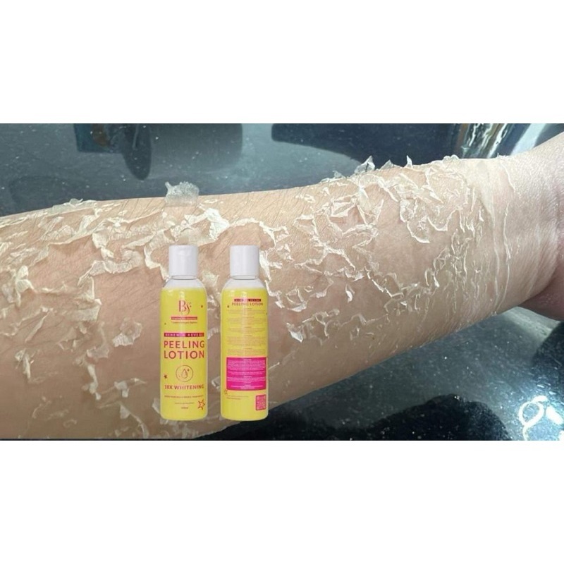 BRIGHTEST SKIN YELLOW PEELING LOTION | Shopee Malaysia