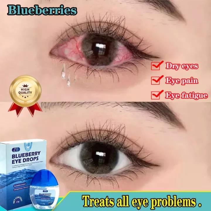 Blueberry Eye Drop Relieves Red Eyes Discomfort Blurred Vision Dry ...