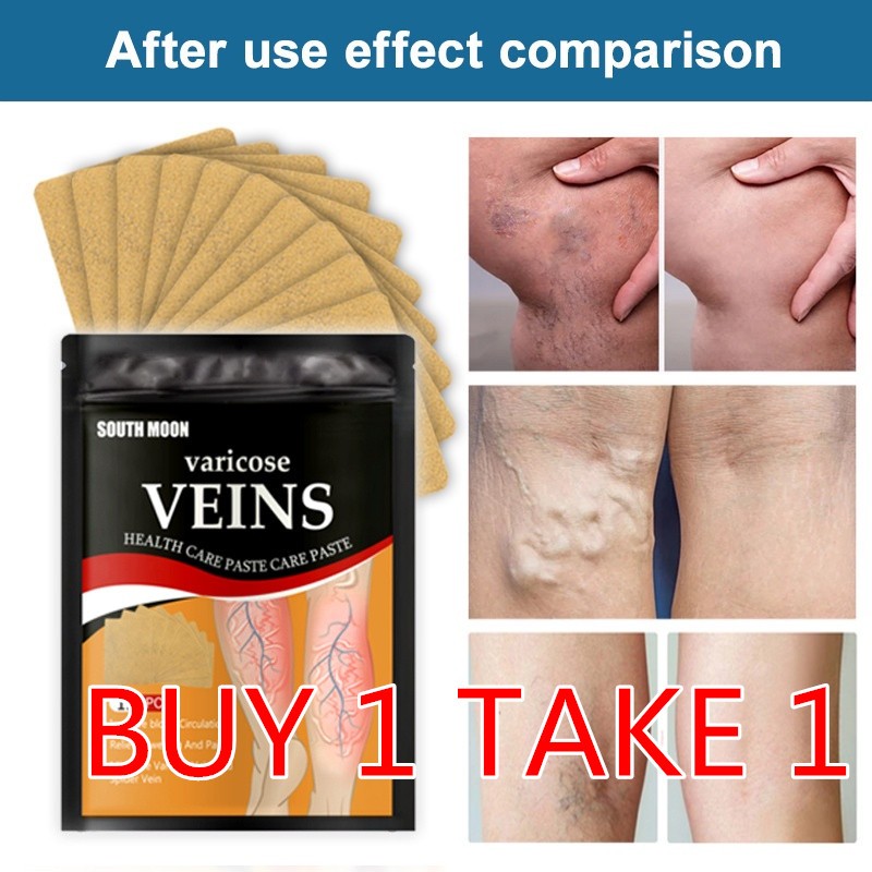 12pcs Varicose Veins Plaster Patch Pain Relief Relievers Knee Patches ...