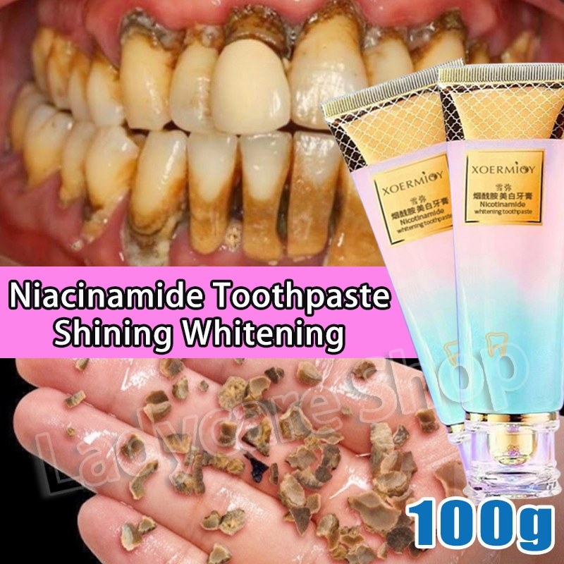 100g Niacinamide Teeth Whitening Toothpaste Cleansing Teeth Remove Tartar Smoke Stains Fresh ...