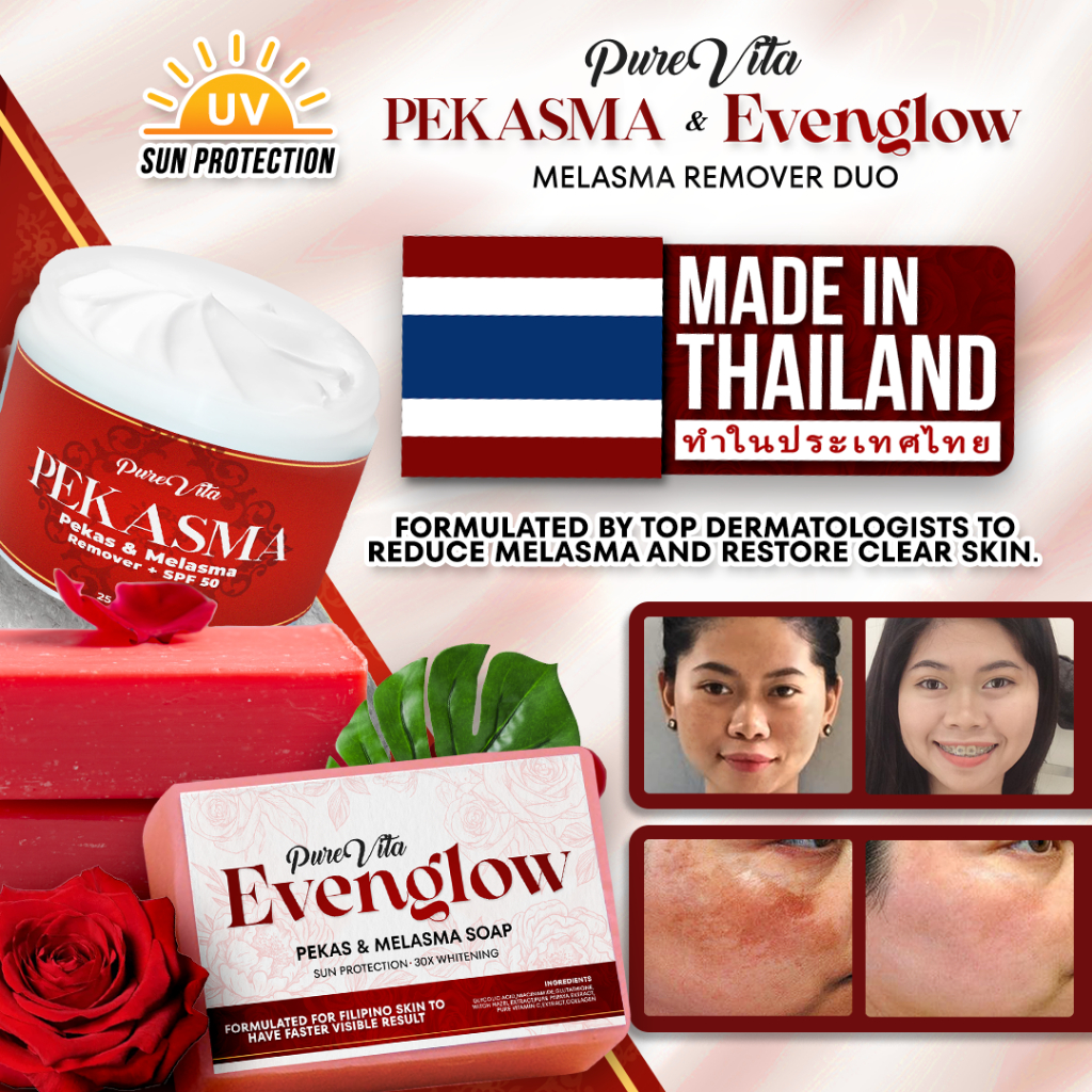 Melasma Duo Set - Pekasma Cream & EvenGlow Soap Remove Melasma, Pekas ...