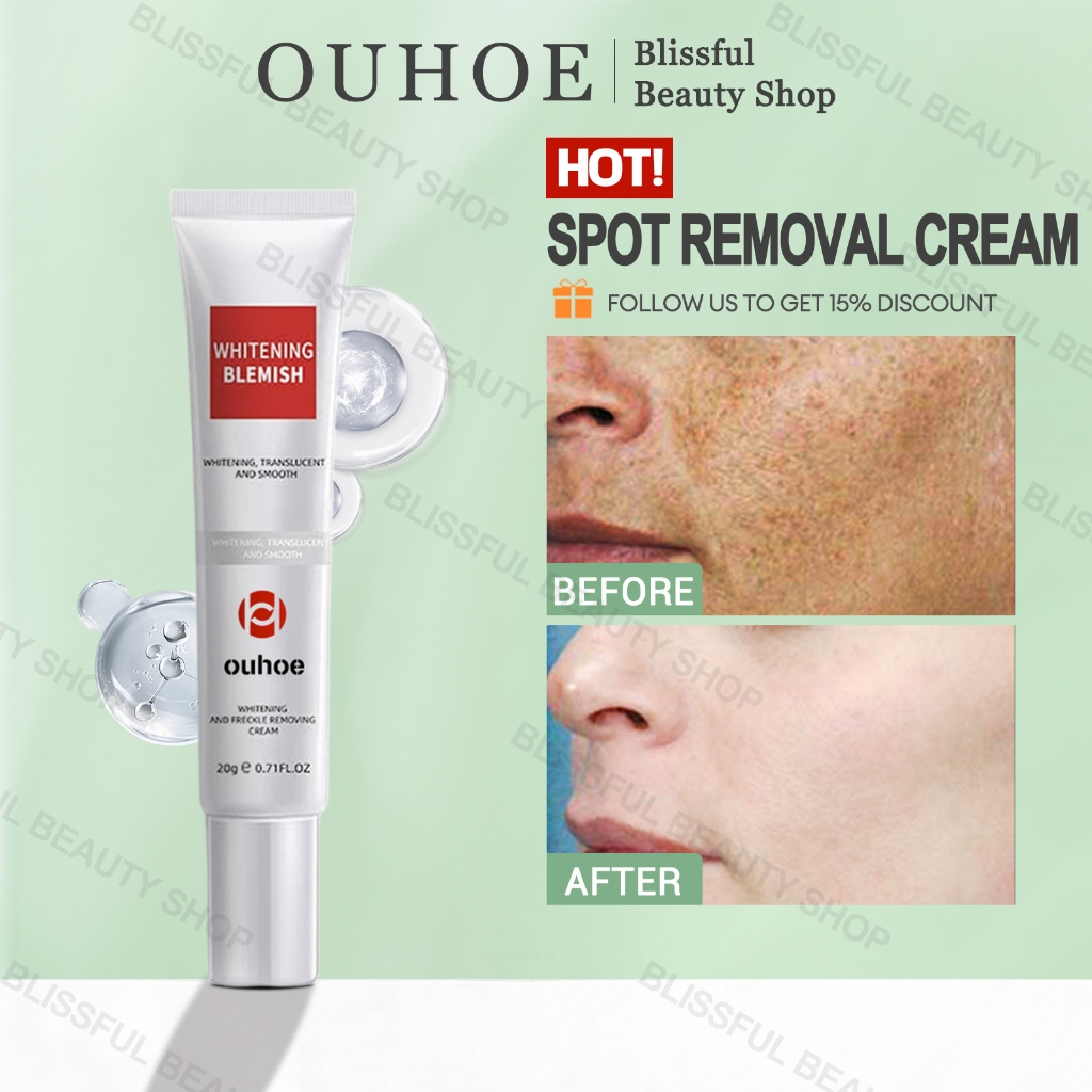 OUHOE Spot Removal Cream 20g Brightens Skin Reduces Dark Spots Improves ... OUHOE Spot Removal Cream 20g Brightens Skin Reduces Dark Spots Improves ...