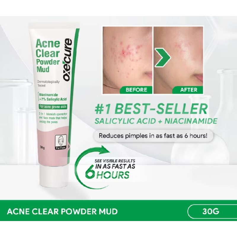 Oxecure Acne Clear Powder Mud 30g NEW Authentic | Shopee Malaysia