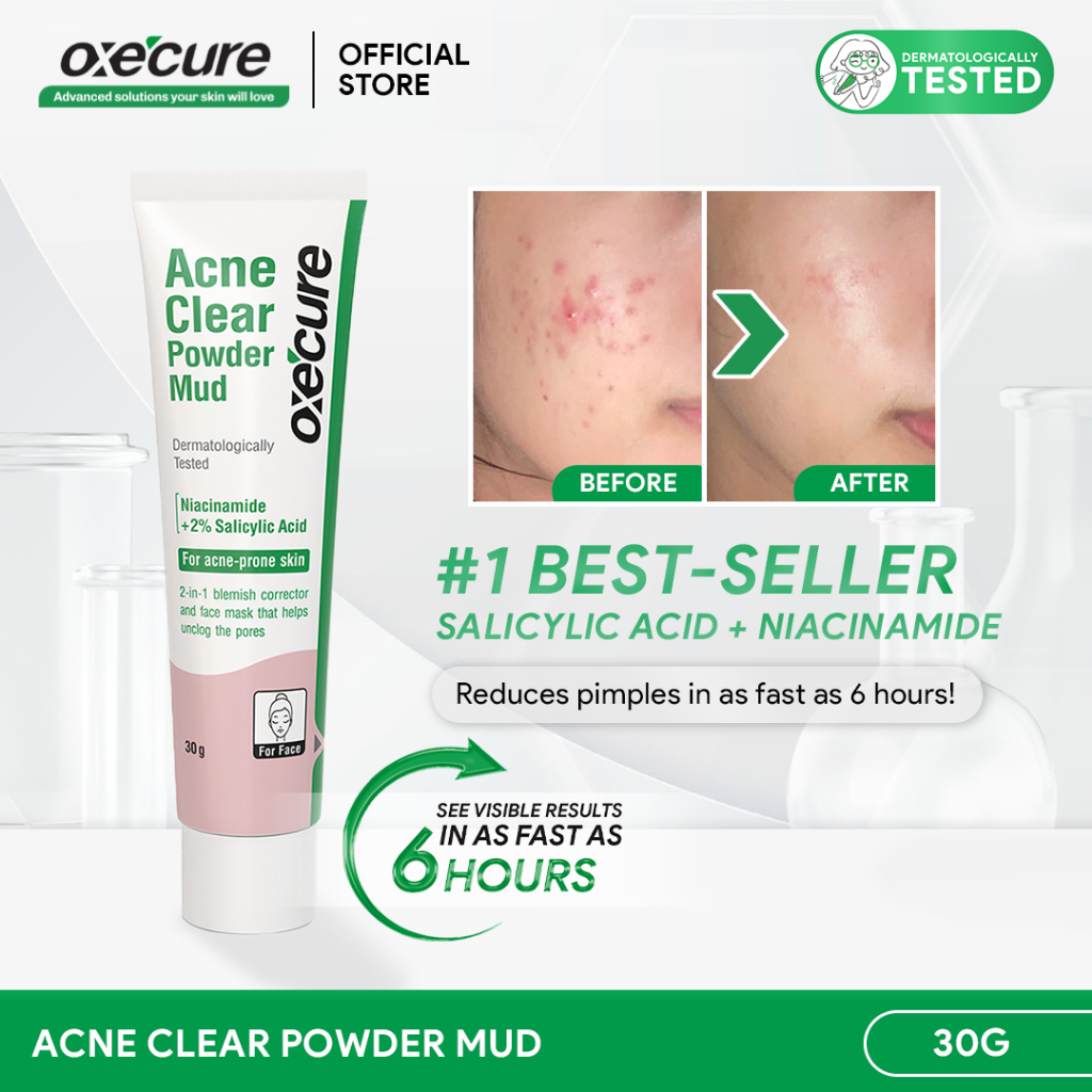 OXECURE 2% Salicylic Acid Acne Clear Powder Mud 30g | Shopee Malaysia