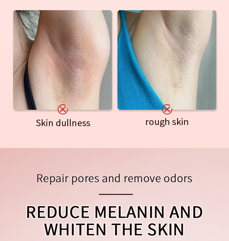 YESHUl Underarm Powder DryDeodorant Magic Underarm Whitening | Shopee ...