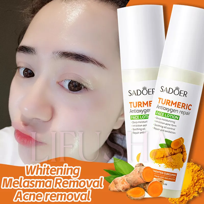 Turmeric Face Lotion cream Melasma Lotion Whitening Pekas Remover Acne ...