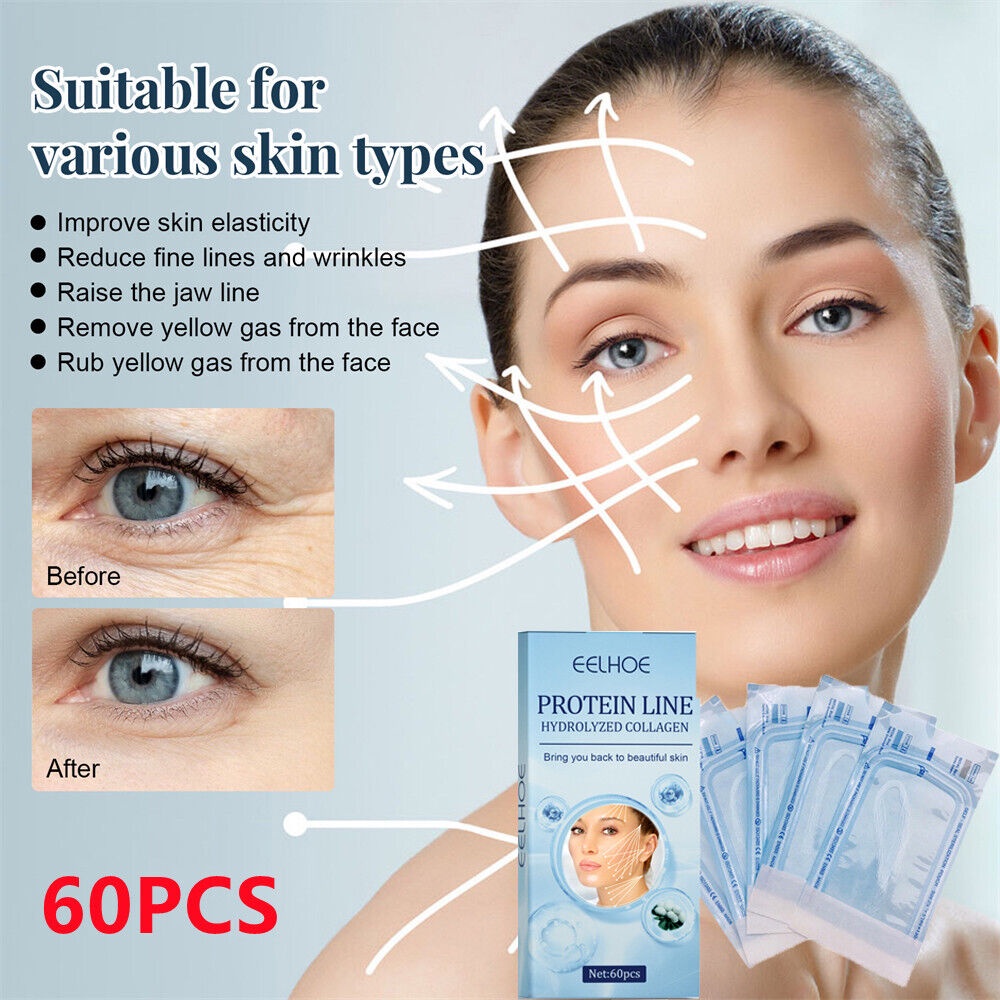 ☺『New』 60Pcs Protein Thread No Needle Gold Protein Line Absorbable Anti ...