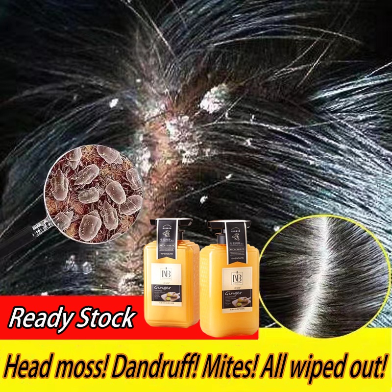 Anti Dandruff Remove Mite Ginger Shampoo Hair fall Anti Itch ...