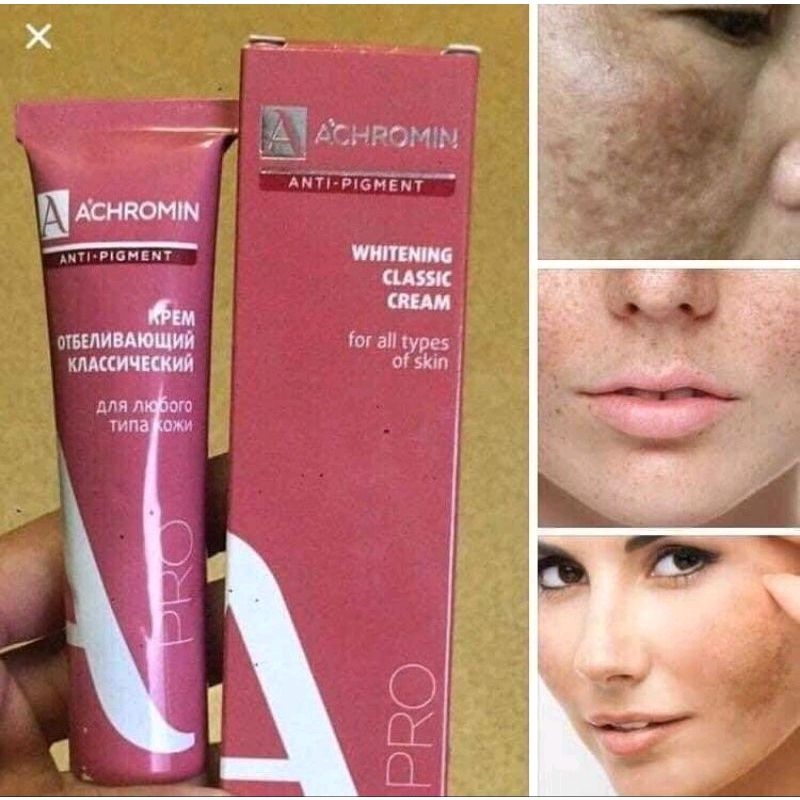 Russian Achromin Melasma Cream - Erase Pigmentation, Age Spots ...
