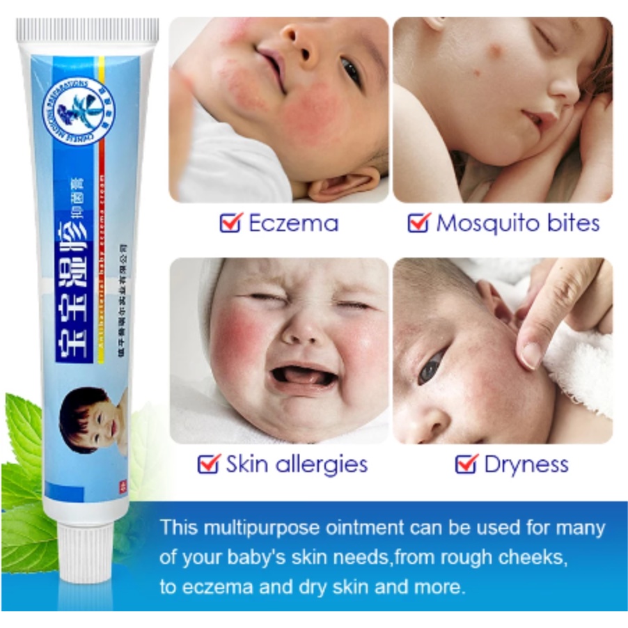 Baby Butt Rash Cream / Krim Ubat Gatal bayi 20g penyakit kulit & Nyamuk ...