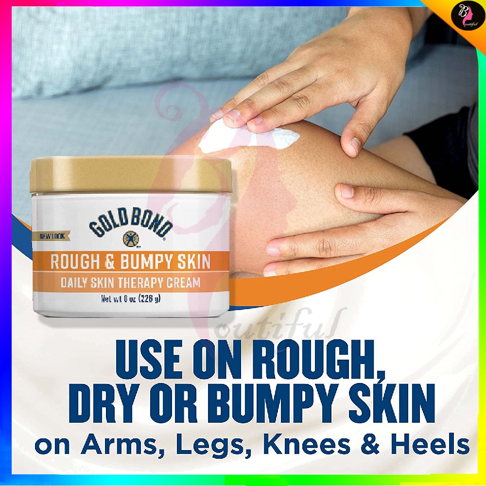 Gold Bond Ultimate Rough & Bumpy Skin Daily Cream 226g Body ...