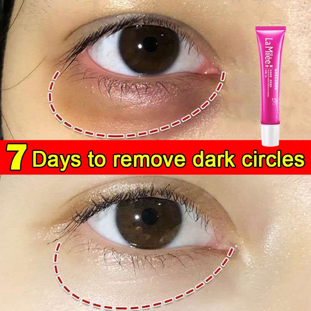 🔥Malaysia Spot🔥Eye cream fat anti wrinkle dark circles eyebag repair ...