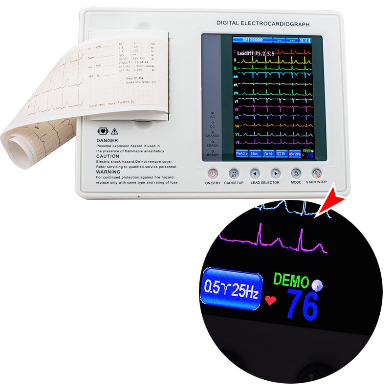 (Ship Today)ecg machine portable EKG Machine Digital Color LCD Machine ...