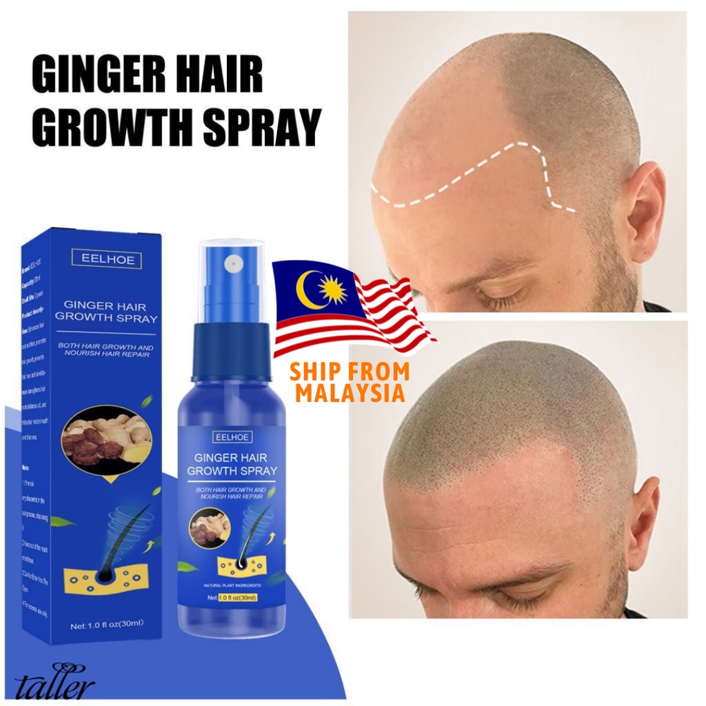 Ginger Hair Growth Spray(30ml)/Anti Hair Loss/Serum Pelebat Rambut/Hair ...