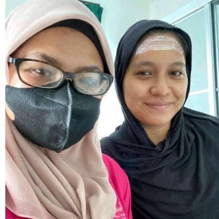 Pilis Dahi untuk Pantang - Calming Cream | Shopee Malaysia