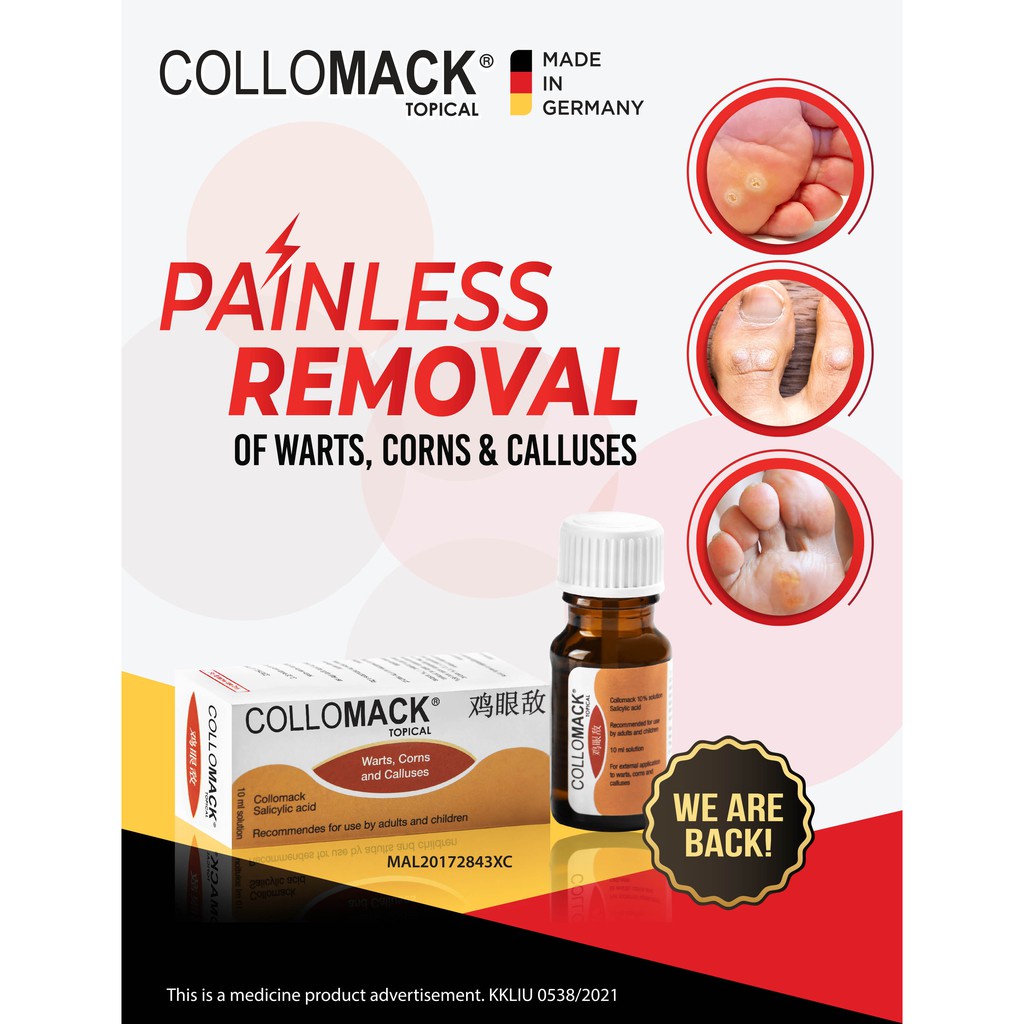 Collomack Topical Solution 10% - painless remover of warts, corns ...