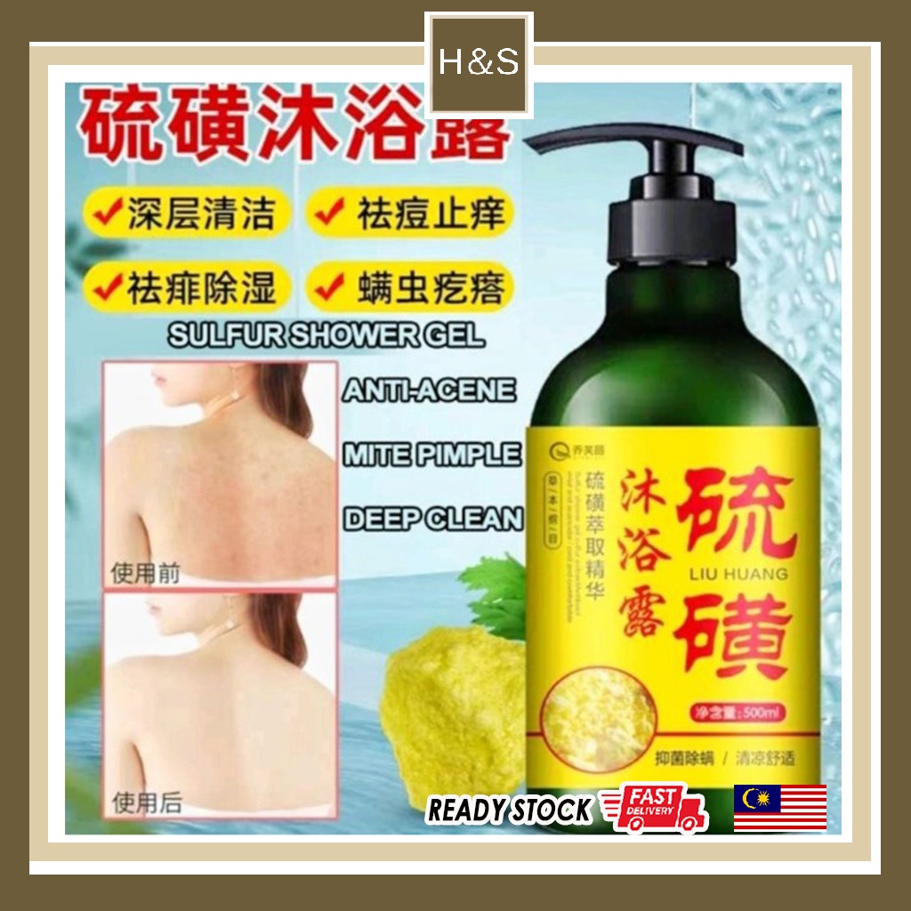 Sulfur Shower Gel 500ml For Medicated Itching Mite Removal 硫磺沐浴露 ...