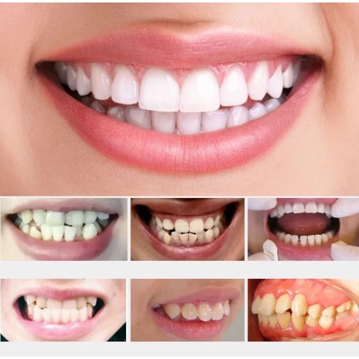 Original messy Teeth straightener. Non-flat Teeth straightener ...