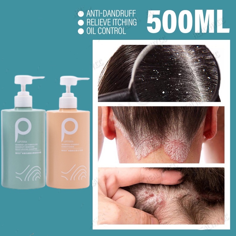 shampoo kelemumur Anti Dandruff Shampoo Conditioner scalp treatment ...