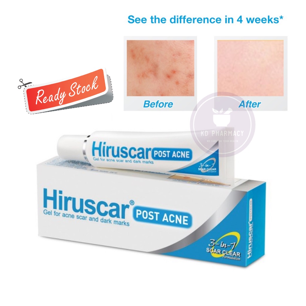 Hiruscar Post Acne Gel for dark spot, acne scar 10g / hilangkan Parut ...
