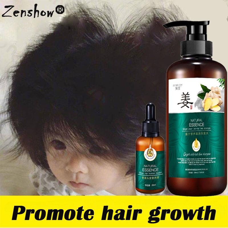 serum rambut gugur Hair Growth Essence oil Anti hair Loss Liquid Fast ...