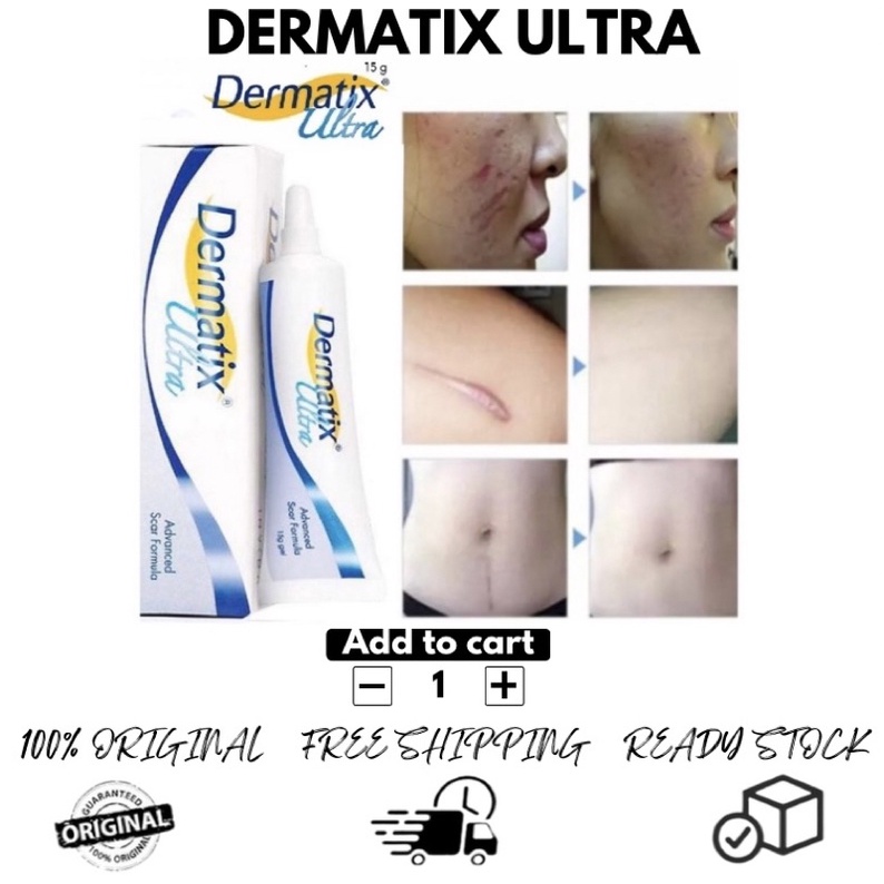 Dermatix Ultra gel 15g Advance Scar Formula Removal Repair Skin Care ...