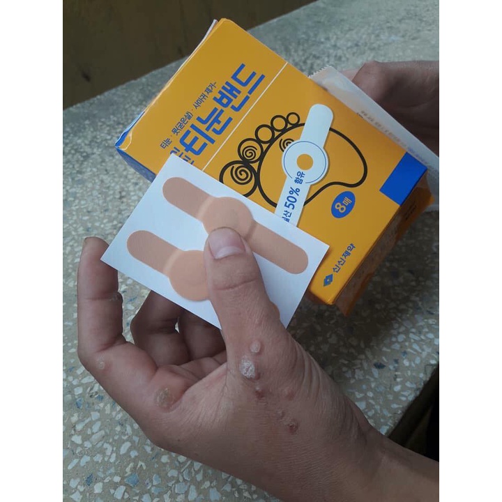 Acne PATCH, ACNE, EYE, FISH, FEET KOREAN | Shopee Malaysia