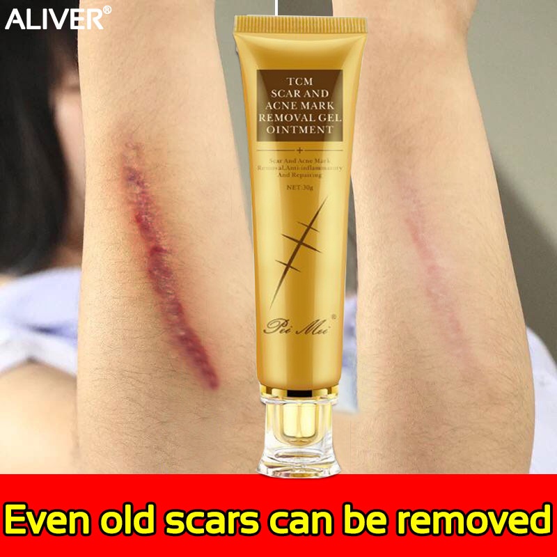 Scar and pockmark Removal Gel 80g skin repair scar and pockmark removal ...