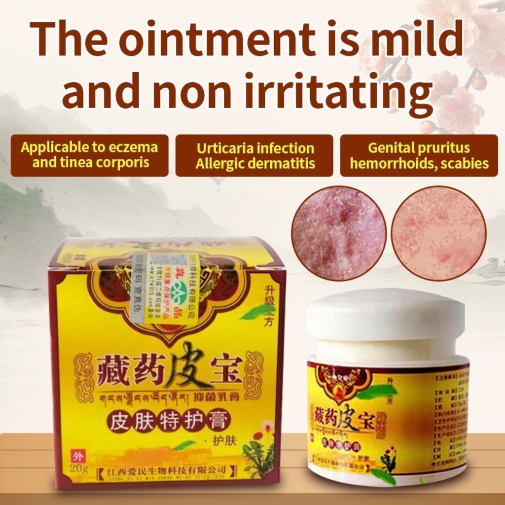 Krim gatal kulit/ubat panau mujarap/ubat gatal/eczema treatment/ubat ...