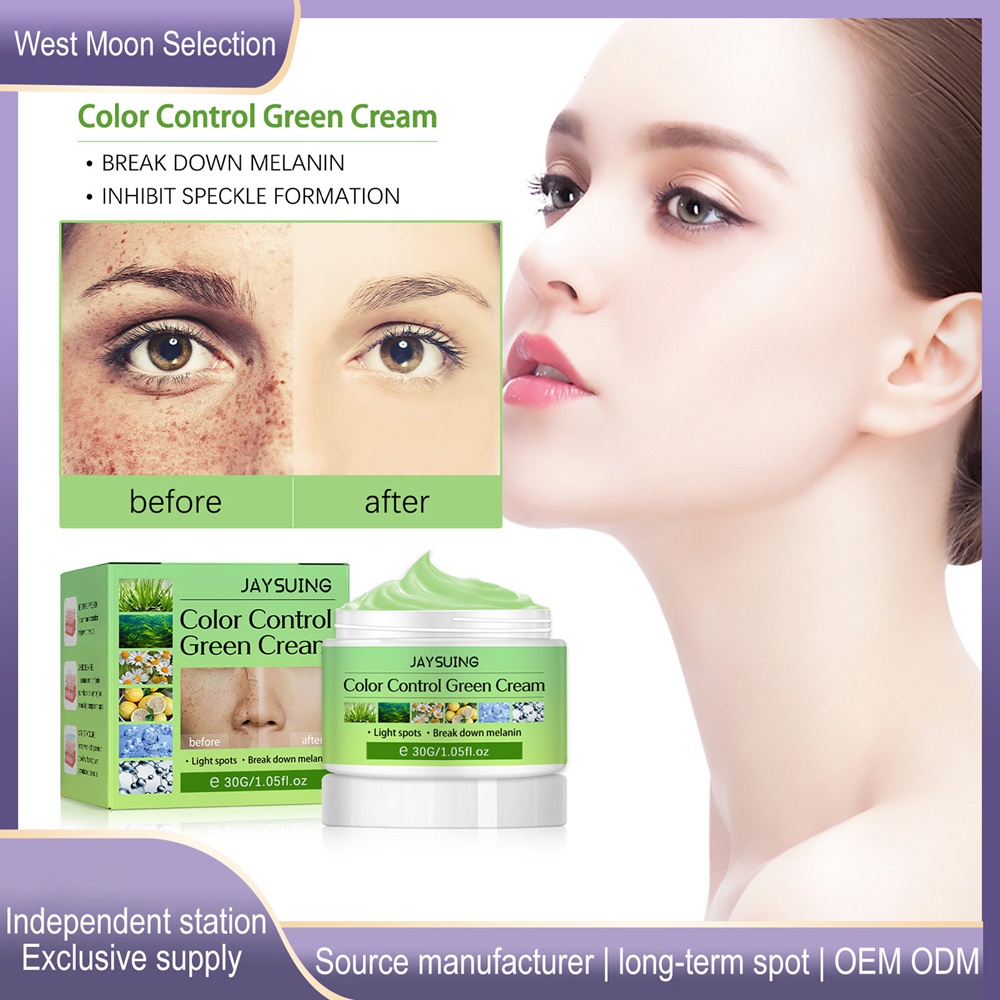 Whitening Freckles Cream Remove Melasma Dark Spot Lightening Melanin ...