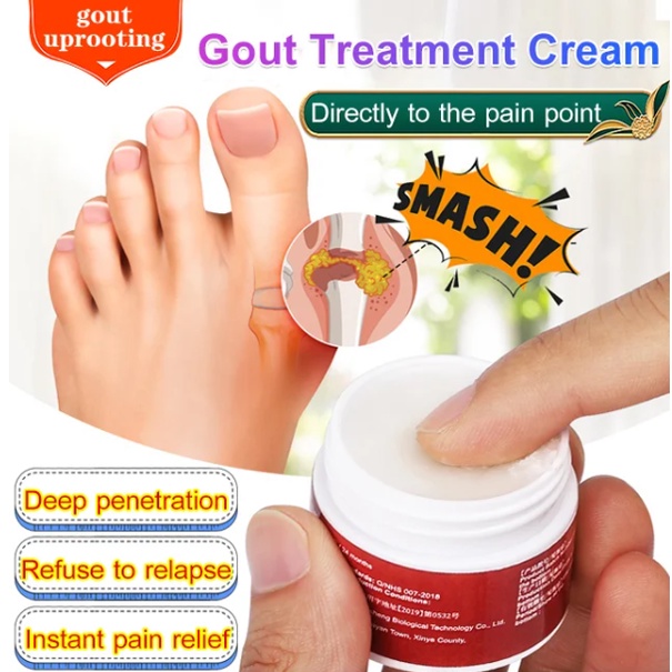 🔥[1/2PCS]Gout Treatment Cream | Gout Pain Relief Ointment 痛风膏 | Shopee ...