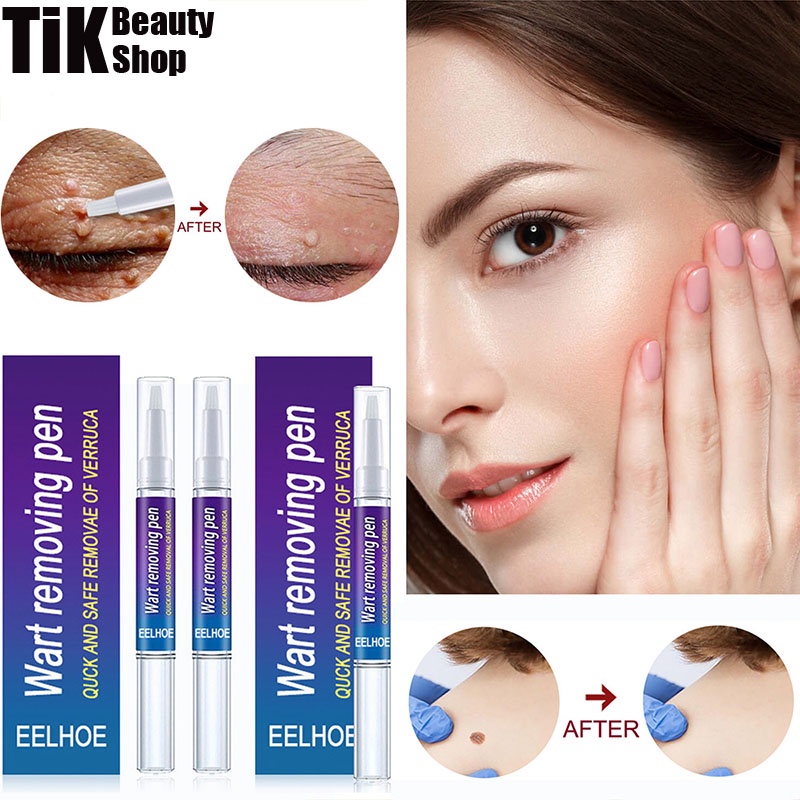 Warts Remover Original Warts And Skin Tags Remover Wart Ointment Warts ...