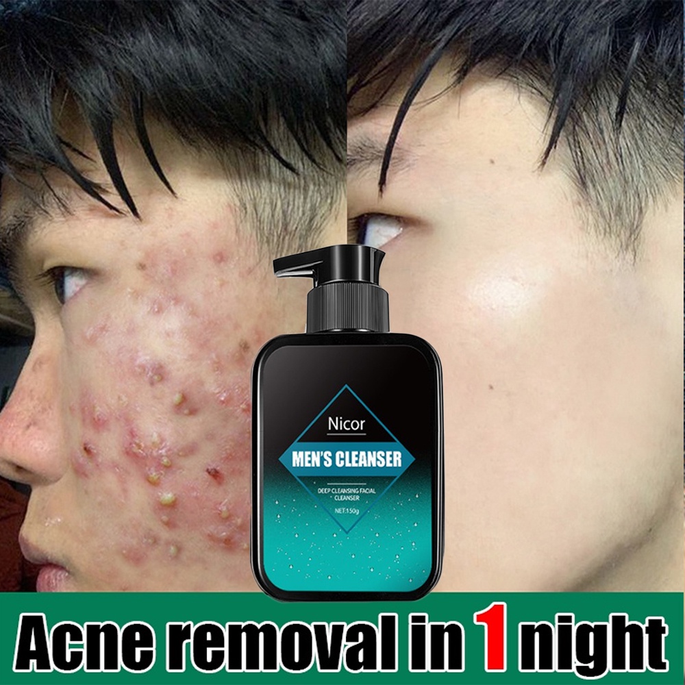 Mens Facial Cleanser Penghilang Jerawat Pencuci Muka Lelaki Sabun Cuci Muka Mites Acne Cleanser