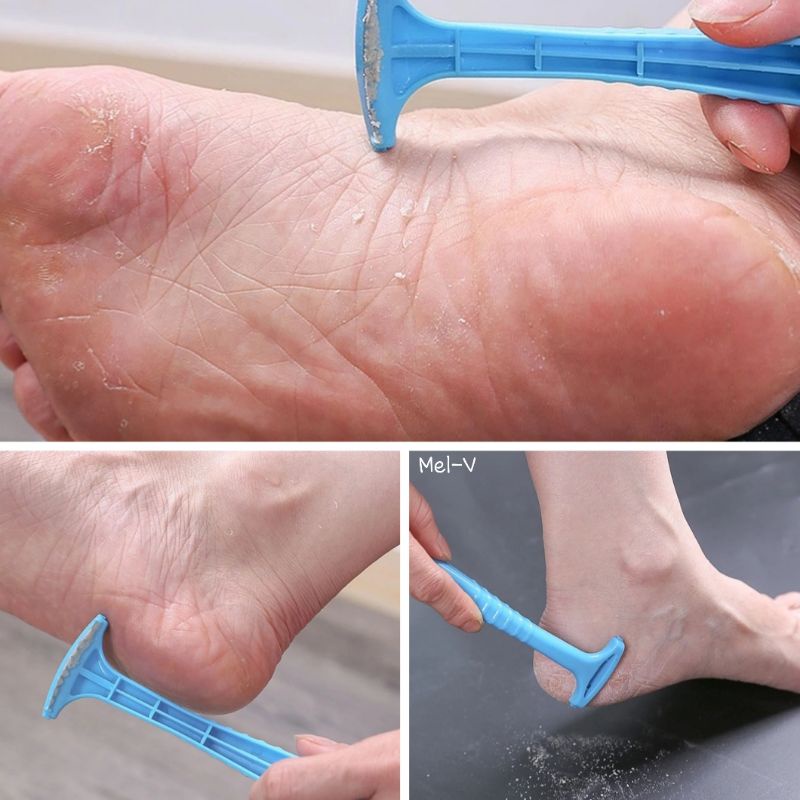 Medicure Pedicure Foot Heel Smoother Dead Skin Scraper Tool | Shopee ...