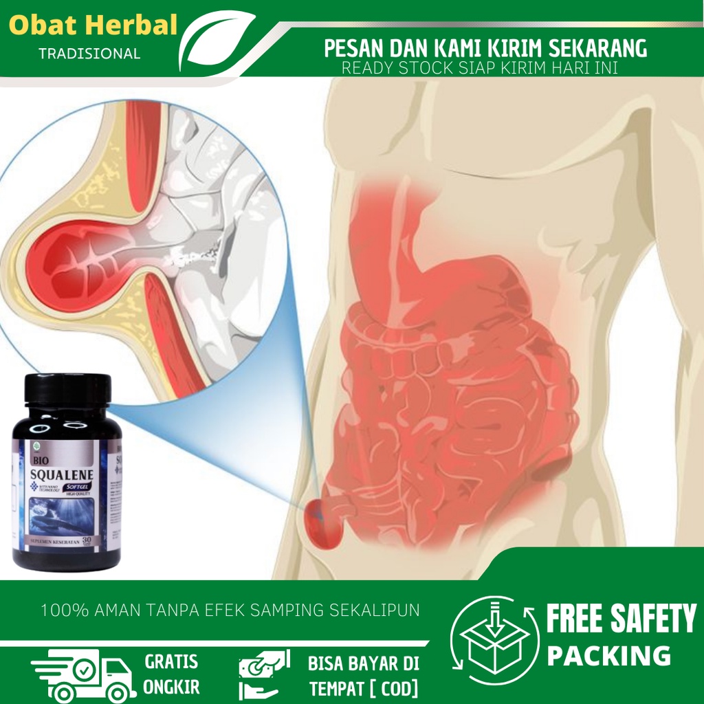 Natural Hernia Medicine, Natural Hydrokel Medicine, Swelling Drug, Big ...