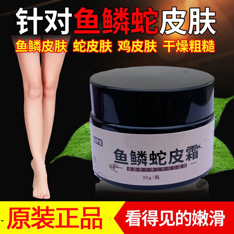 Fish Scale Snake Skin Cream Chicken Remove Dry Peeling Body Ointment ...