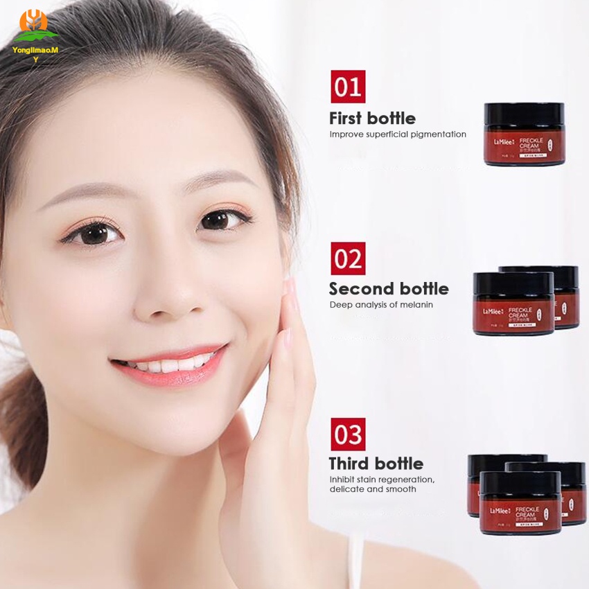 Dark Spot Corrector Cream Whitening Freckle Cream Powerful Removing Melasma Melanin Dark Spots ...