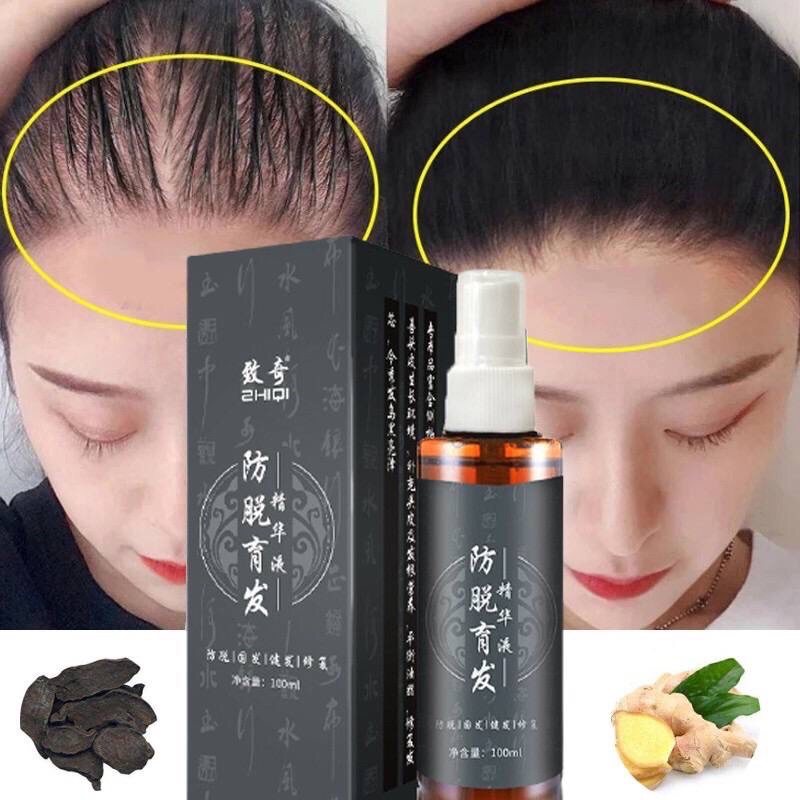 SPRAY ANTI RAMBUT GUGUR prevents hair loss Pelebat rambut tumbuhkan ...