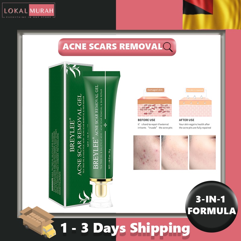LMS | Breylee Acne Scars Removal Gel Anti Acne Scars Whitening Skin 30g | Shopee Malaysia