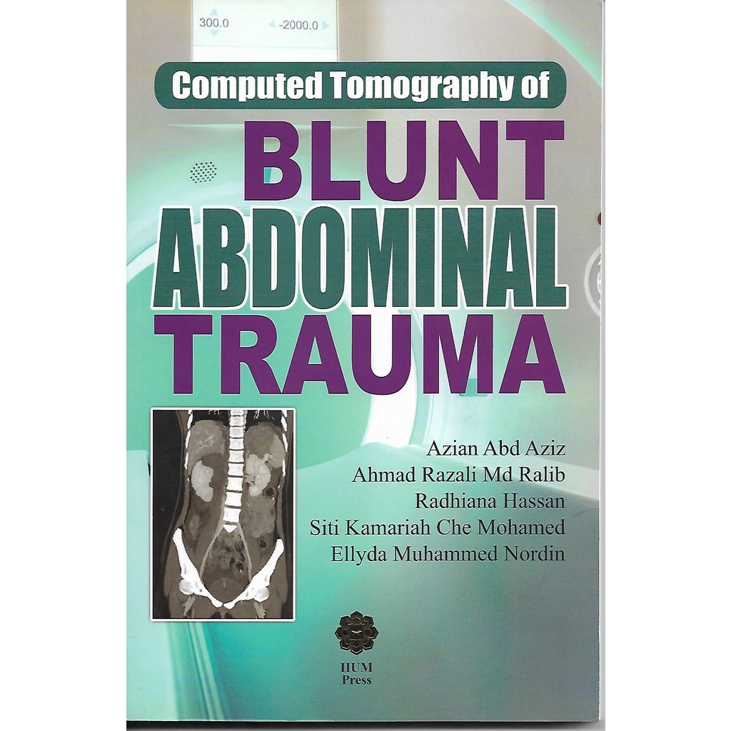 Computed Tomography of Blunt Abdominal Trauma | Shopee Malaysia