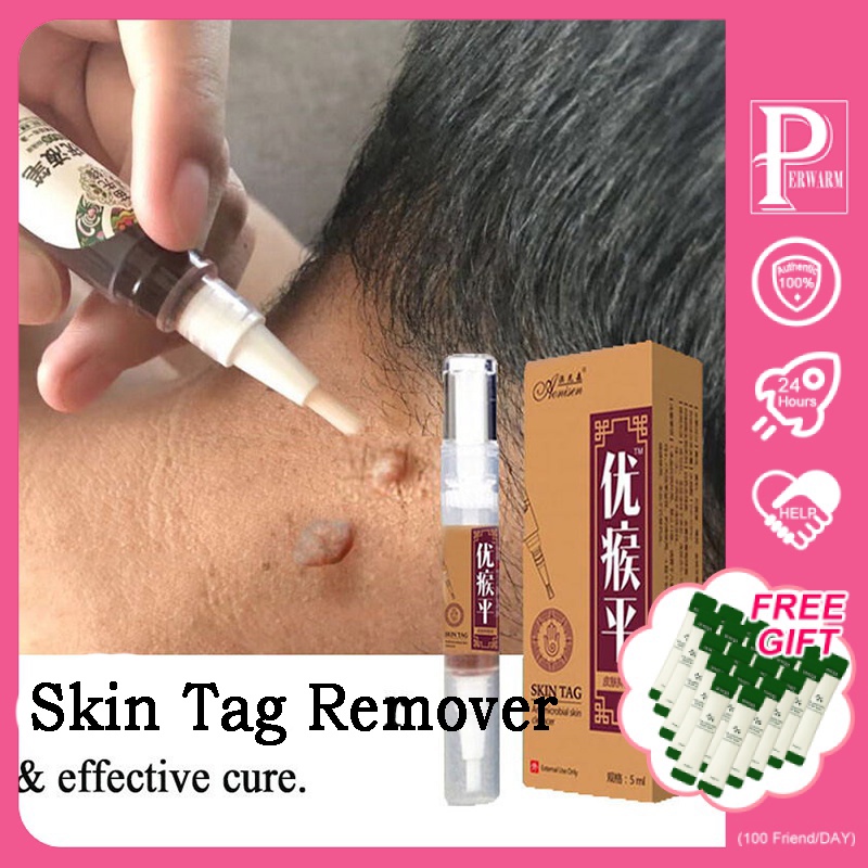 ⚡Ready Stock⚡Wart Removal Cream Skin Tag Remover Against Mole Foot Corn ...