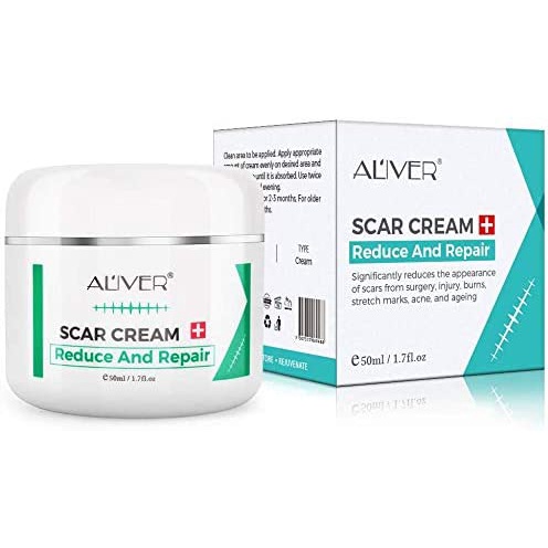 Ready Stock 50ml ALIVER Scar Removal Cream For New Old Scars Scar Gel ...