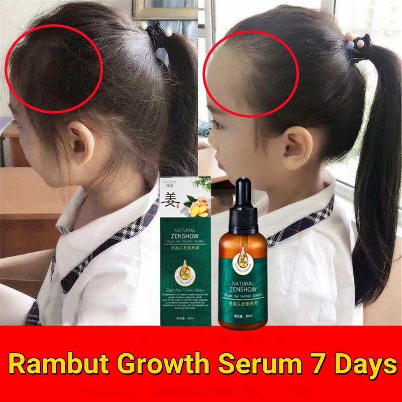 serum rambut hair growth serum penumbuh rambut serum rambut lelaki h ...