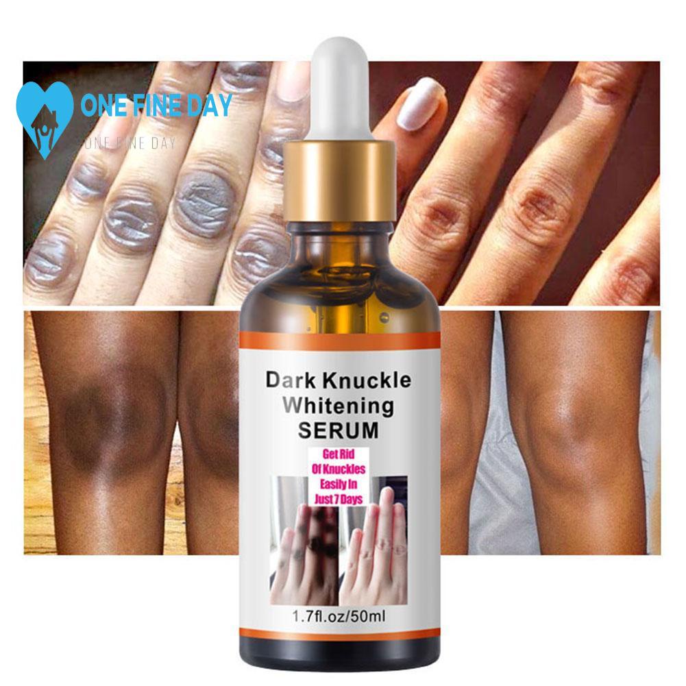 Get Rid Of Dark Knuckles In 7 Days Serum Whitening Removing Dark ...