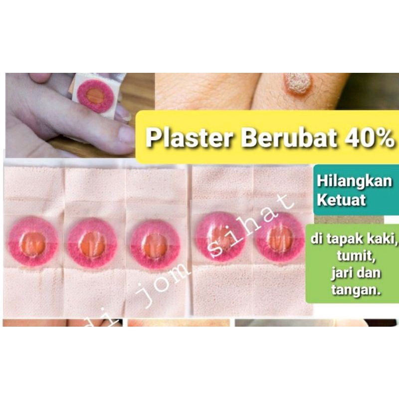 Plaster Ubat Merawat Ketuat Tapak Kaki Jari Tangan 5 keping | Shopee ...