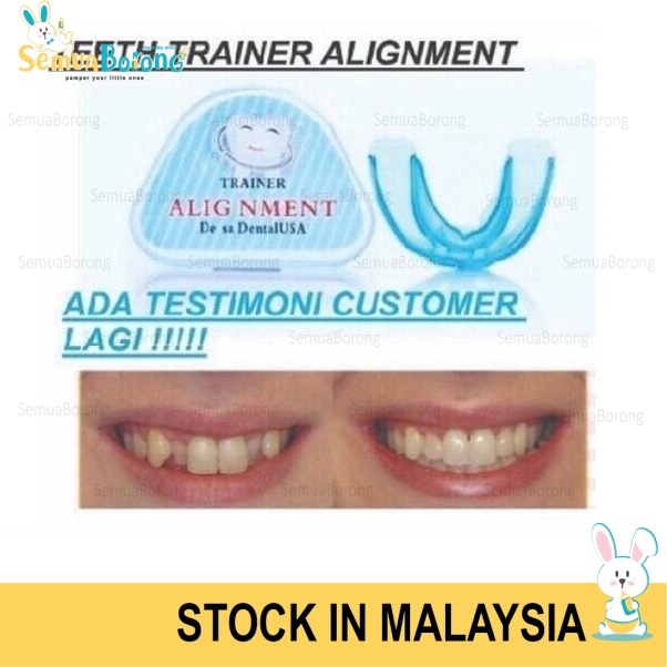 Teeth Trainer Teeth Orthodontic Retainer Alignment Orthodontic Tooth ...