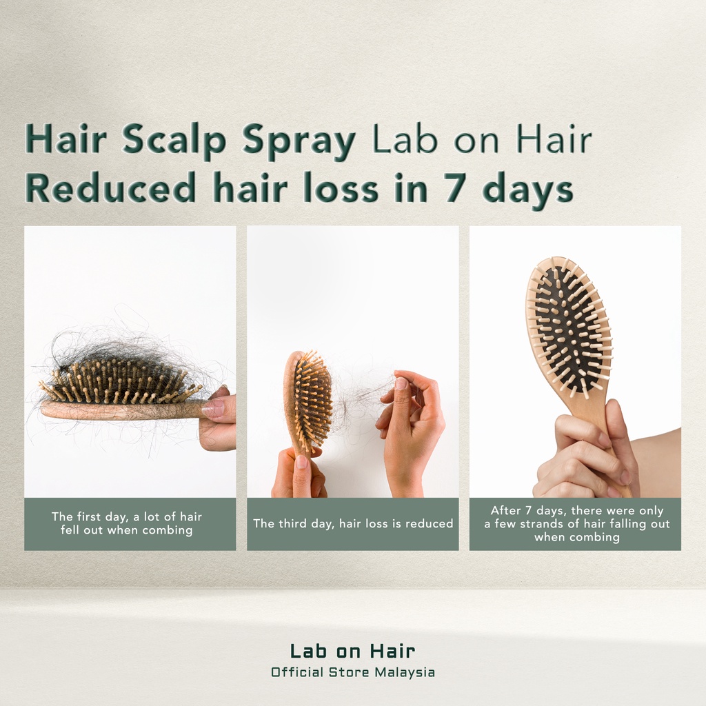 Lab On Hair Anti Hair Loss Scalp Spray - Tonik Rambut Spray Anti ...