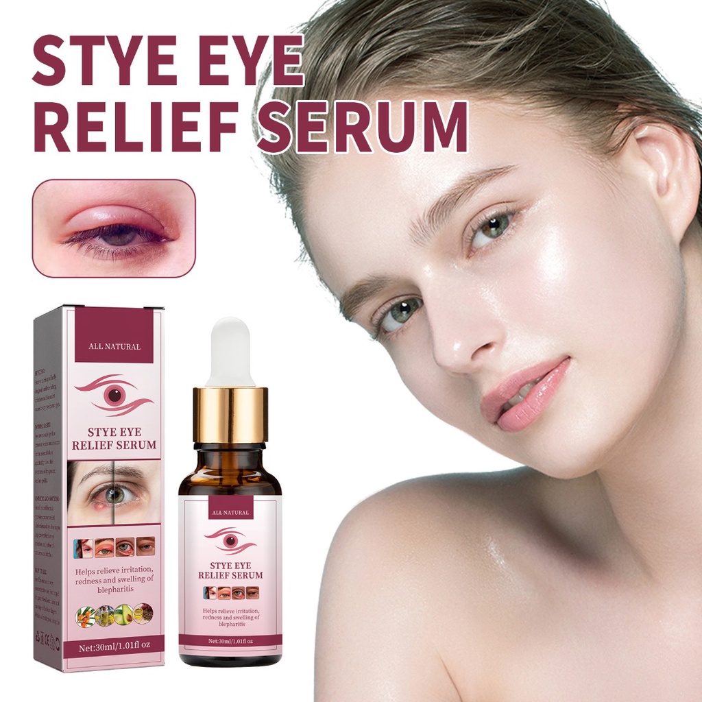 Stye Eye Relief Serum for Styes Chalazion Blepharitis Treatment Gentle ...